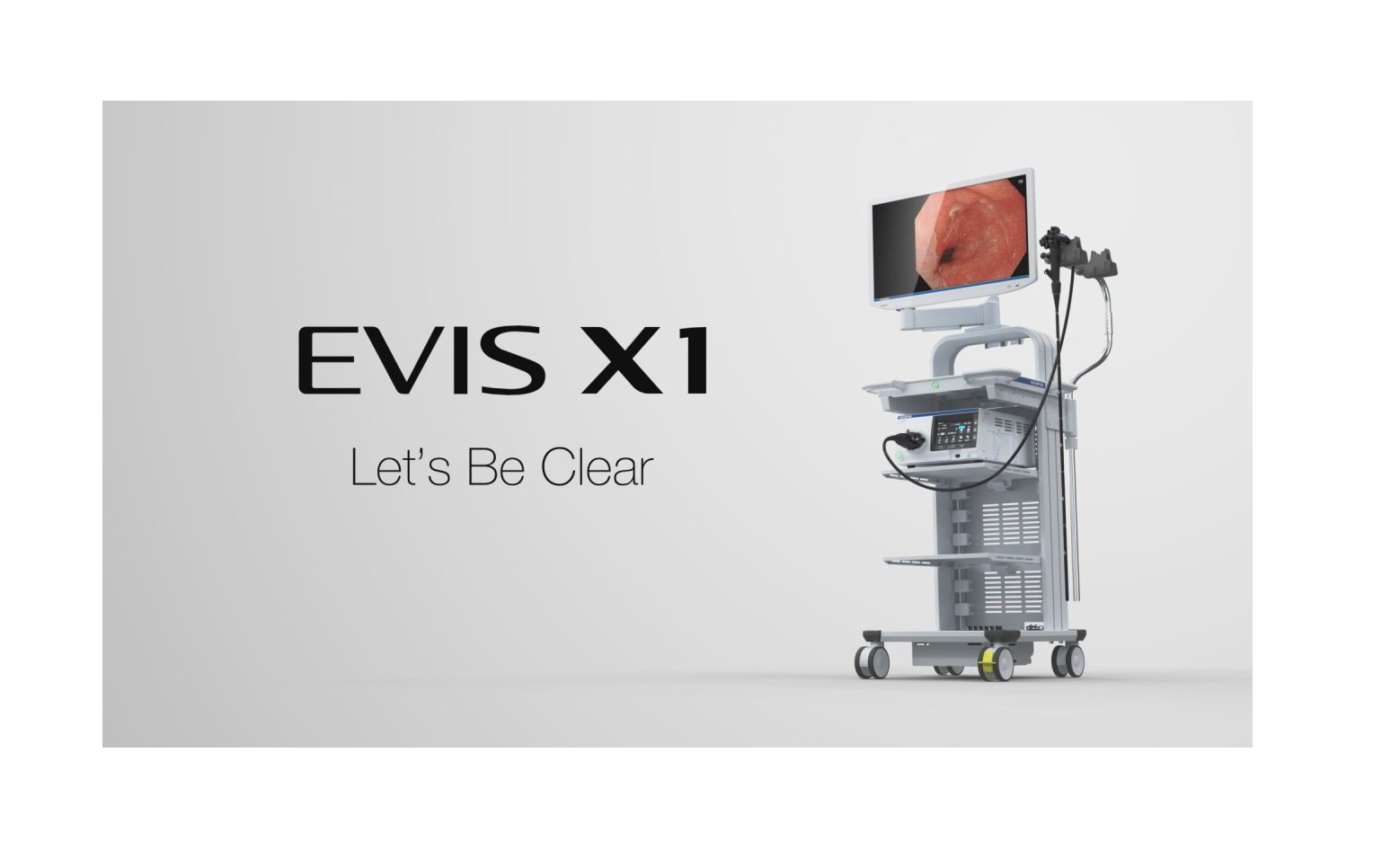 最新鋭の内視鏡システム「EVIS X1」 ｜目黒区の学芸大駅前内科・内視鏡クリニック